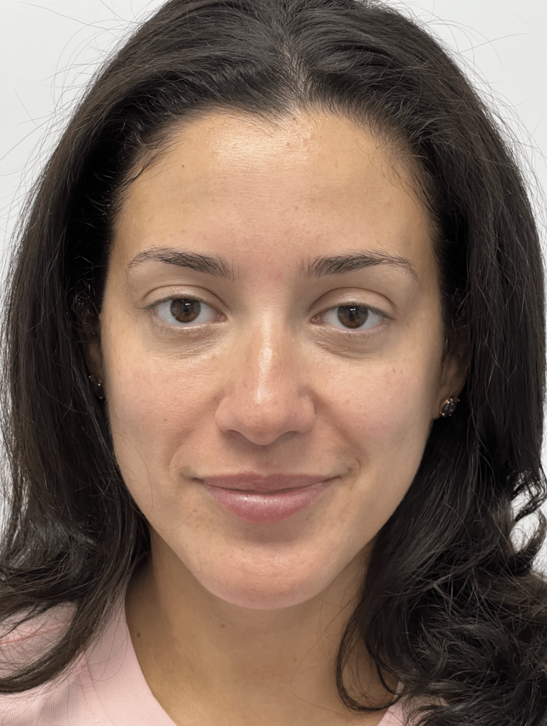 Glow with Glo2 Luxe Facial | Rejuvenate Your Skin Today
